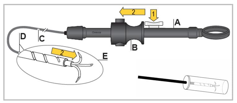 OTSC® Proctology Anchor - Ovesco Endoscopy AG