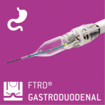FTRD® System - Ovesco Endoscopy AG