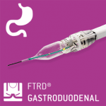 Ovesco Endoscopy AG - gastroduodenal FTRD®