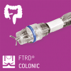Ovesco Endoscopy AG - colonic FTRD®